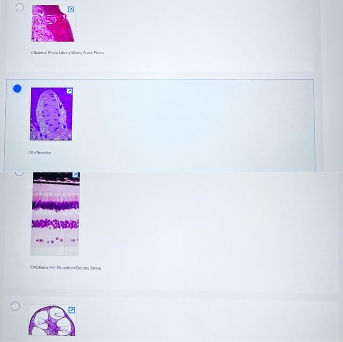 Solved 1. Which micrograph includes the receptors for | Chegg.com