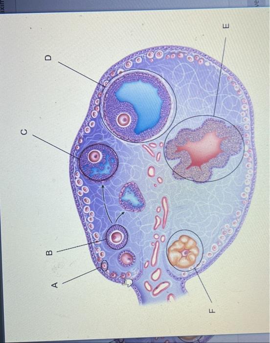 Solved identify the stage in follicular development depicted | Chegg.com