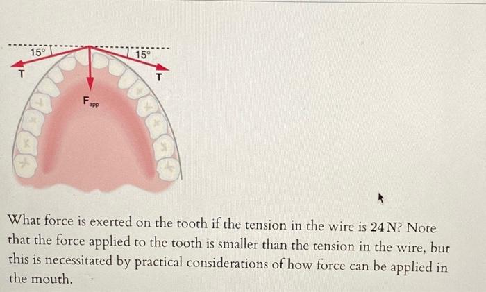 Solved 15° 15° T T What force is exerted on the tooth if the | Chegg.com