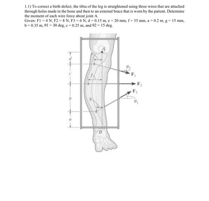 Solved 1.1) To correct a birth defect, the tibia of the leg | Chegg.com