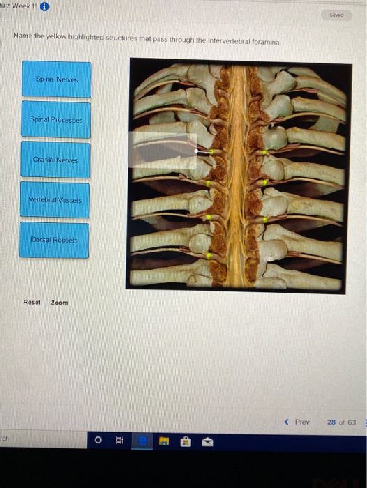 uiz Week 11 Saved Name the yellow highlighted | Chegg.com