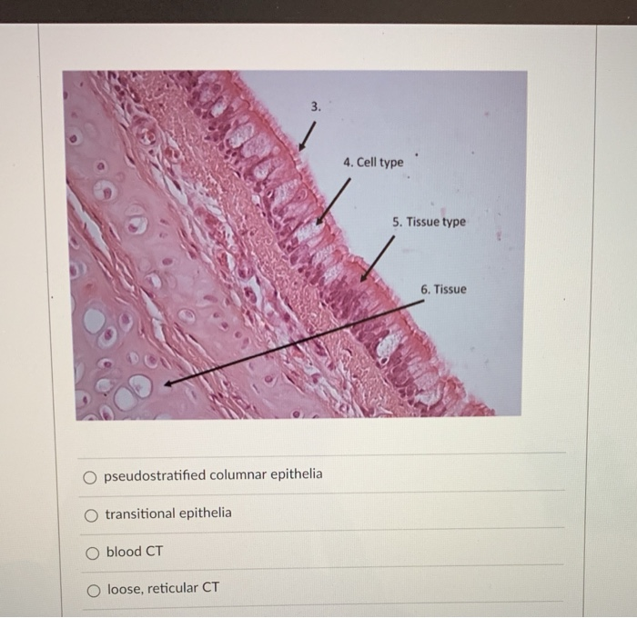 Solved Indicate the type of epithelial tissue, connective | Chegg.com