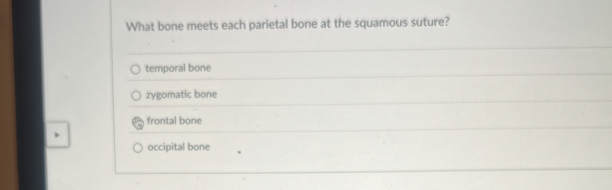 Solved What bone meets each parietal bone at the squamous | Chegg.com