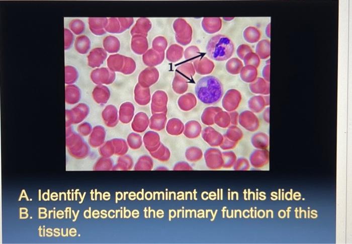 Solved A. Identify the predominant cell in this slide. B. | Chegg.com