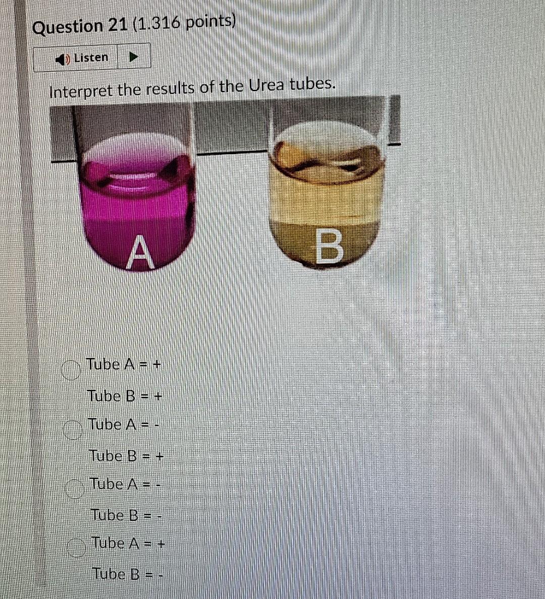 Solved Interpret the results of the Ornithine decarboxylase | Chegg.com