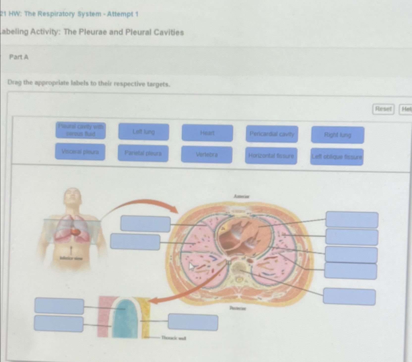 Solved 21 ﻿HW: The Respiratory System - ﻿Attempt 1abeling | Chegg.com