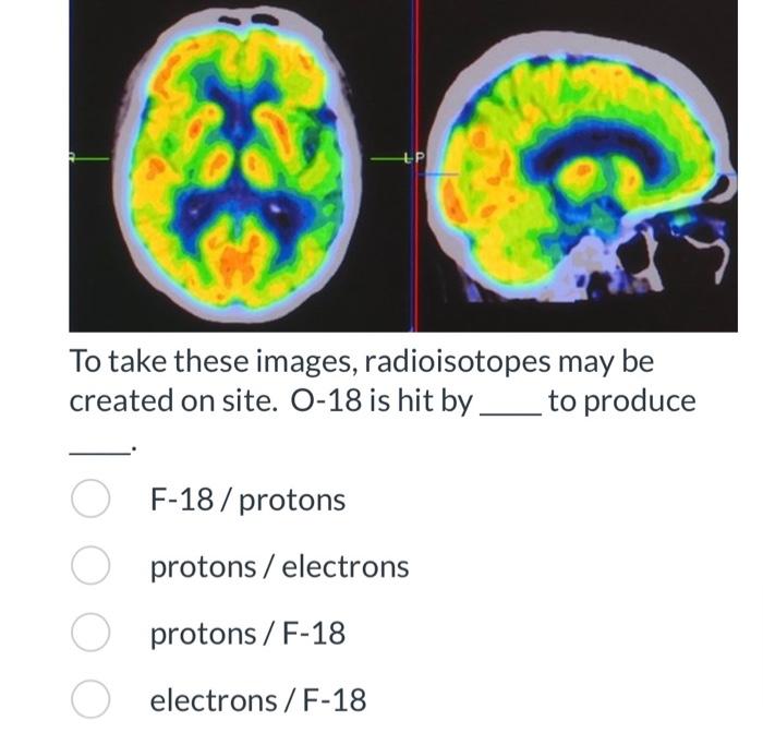 Solved To take these images, radioisotopes may be created on | Chegg.com