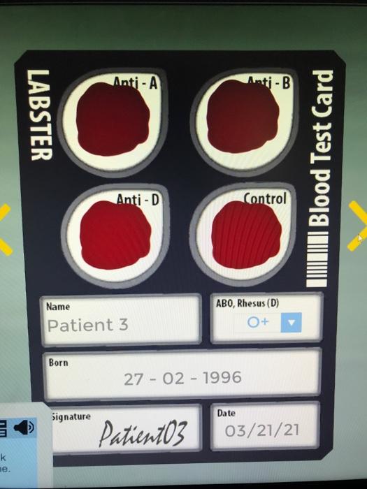 Solved Anti-A LABSTER C C 00 ||||| Blood Test Card Anti-D | Chegg.com
