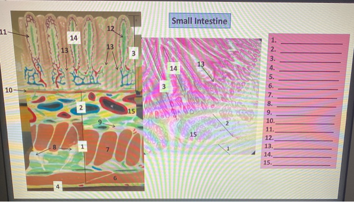 Solved - ล่ า ง เก่ ่ ่ ๒ s - Small Intestine 2014 | Chegg.com