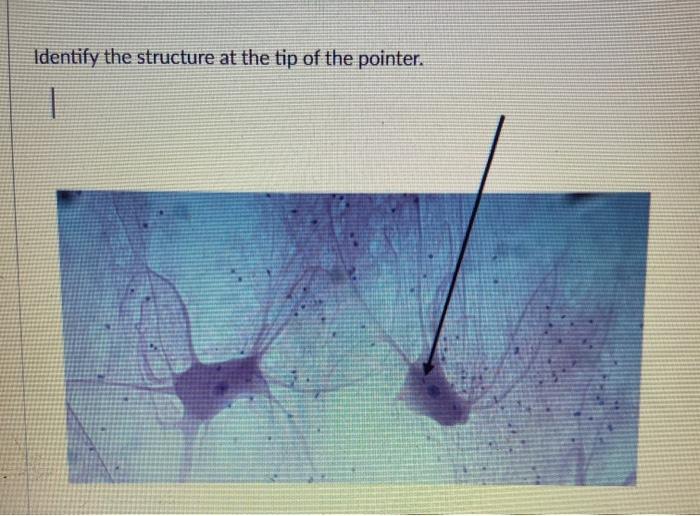 Solved Identify the structure at the tip of the pointer. 1 | Chegg.com