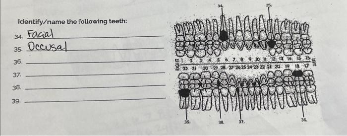 Solved Identify/name the following teeth: 34. Facial 35. | Chegg.com