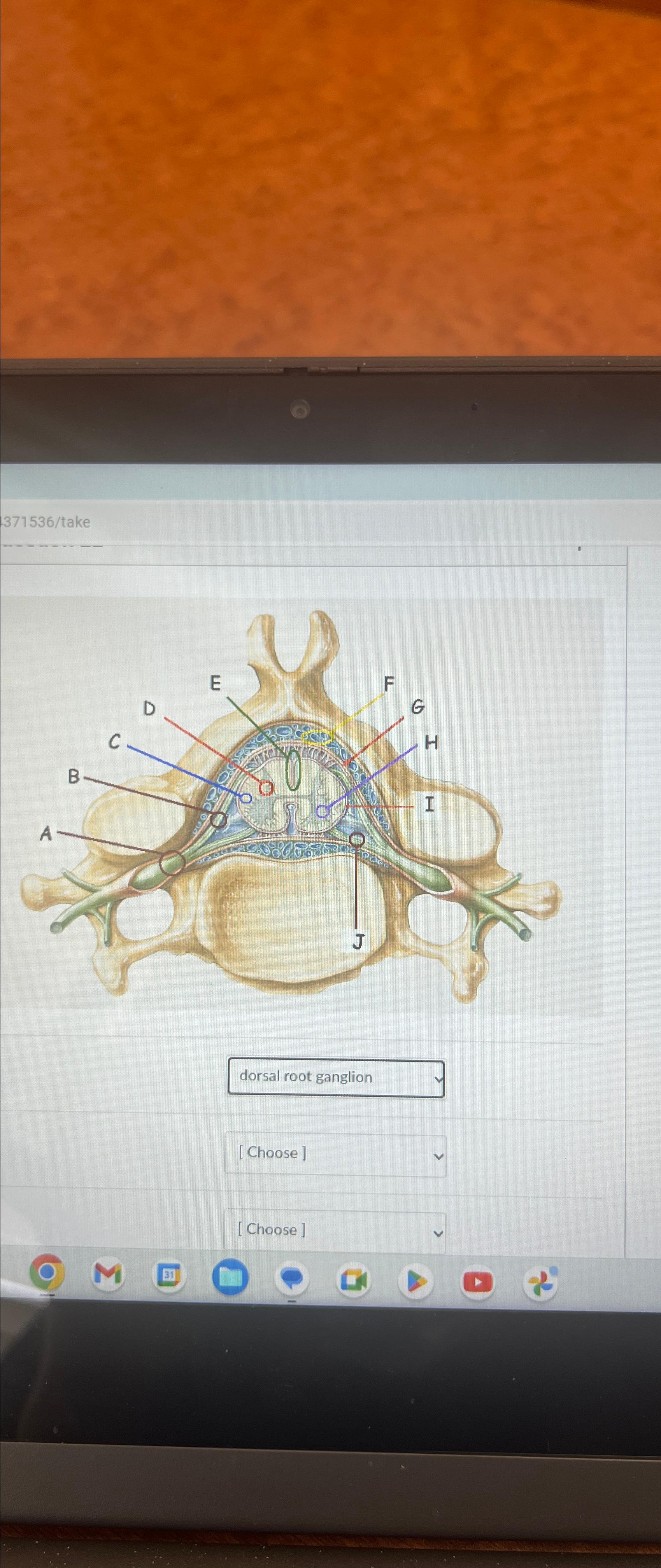 Solved Label the cross section of the spinal cord | Chegg.com
