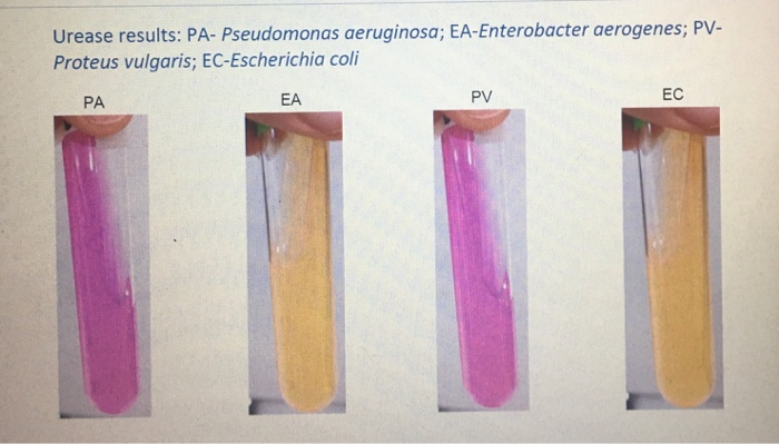 Solved Urease results: PA- Pseudomonas aeruginosa; | Chegg.com