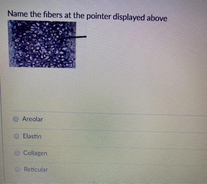 Solved Name the fibers at the pointer displayed above | Chegg.com