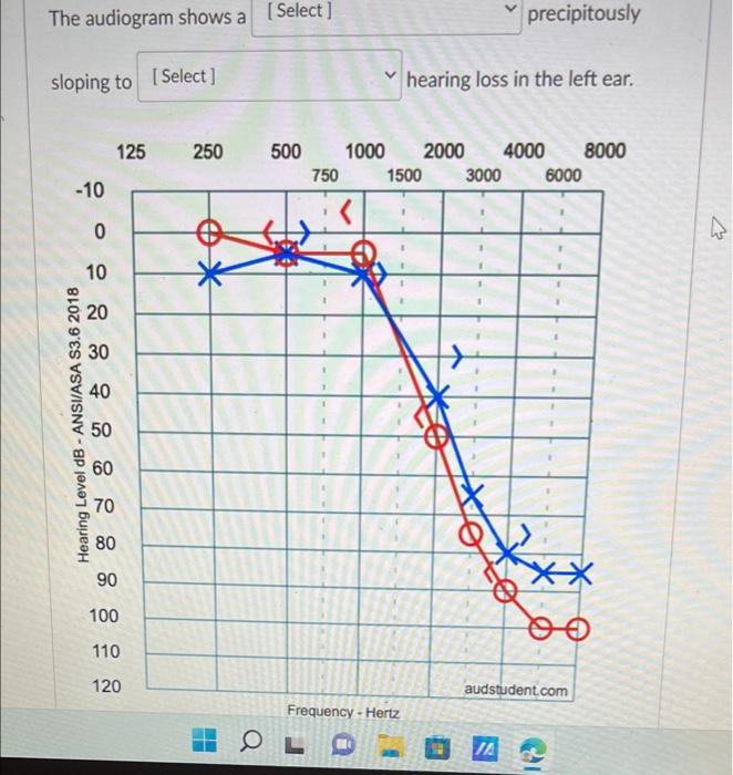 Solved The audiogram shows a [Select] sloping to [Select] | Chegg.com