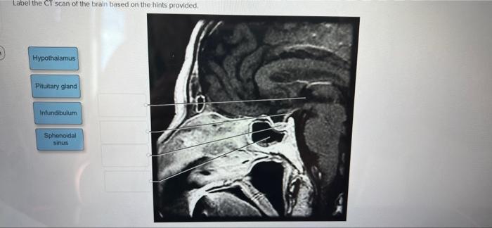 Solved label the ct scan of the brain based on the hints | Chegg.com