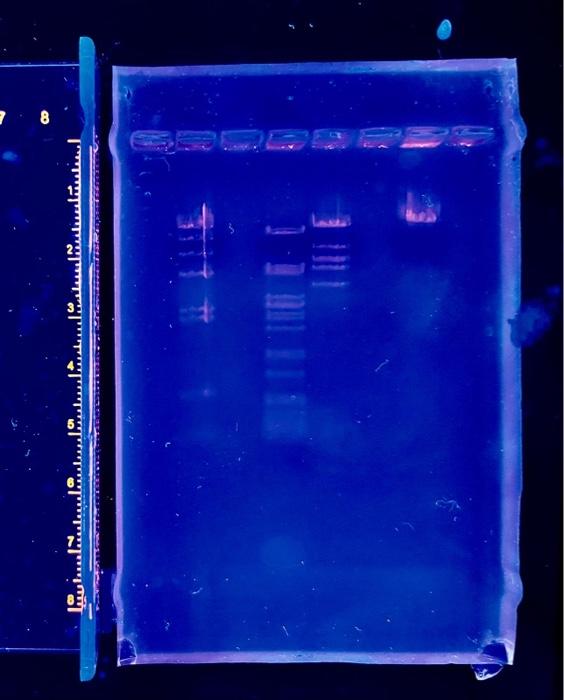 Solved Gel photograph from Nucleic Acids Research, vol | Chegg.com