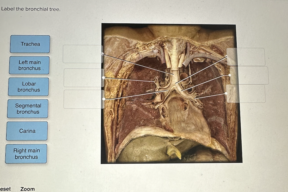 Solved Label the bronchial tree.Segmental bronchusRight main | Chegg.com
