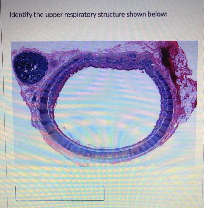 Solved Identify the upper respiratory structure shown below: | Chegg.com