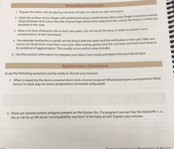 Solved Procedure/Exercise 1. Prepare the Eldon card by | Chegg.com