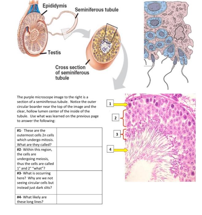 Solved Epididymis Seminiferous tubule - Testis Cross section | Chegg.com