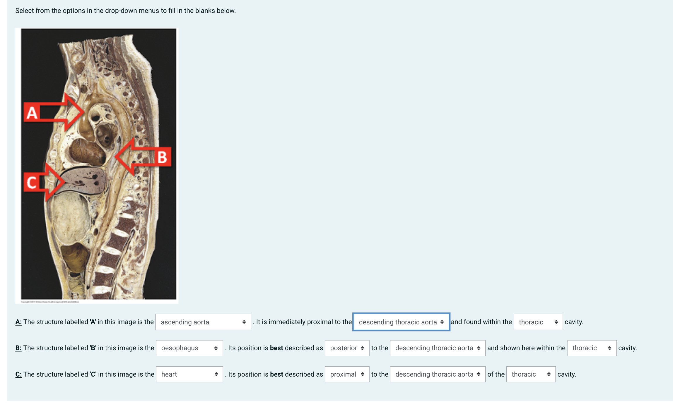 Solved Select from the options in the drop-down menus to | Chegg.com