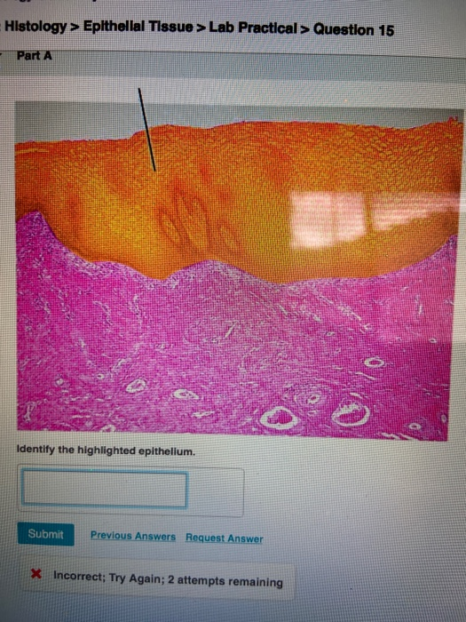 Solved Part A Identify the highlighted epithelium. Submit | Chegg.com Solved Part A Identify the highlighted epithelium. Submit | Chegg.com