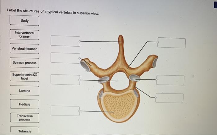 Solved Label the structures of a typical vertebra in | Chegg.com