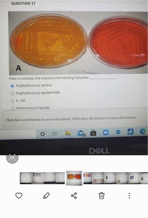 Solved QUESTION 19 A PEA plate is differential @selective o | Chegg.com