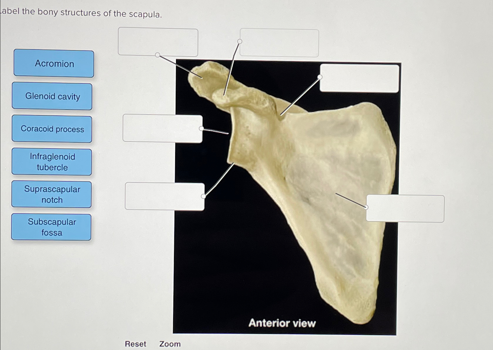 Solved abel the bony structures of the scapula. | Chegg.com