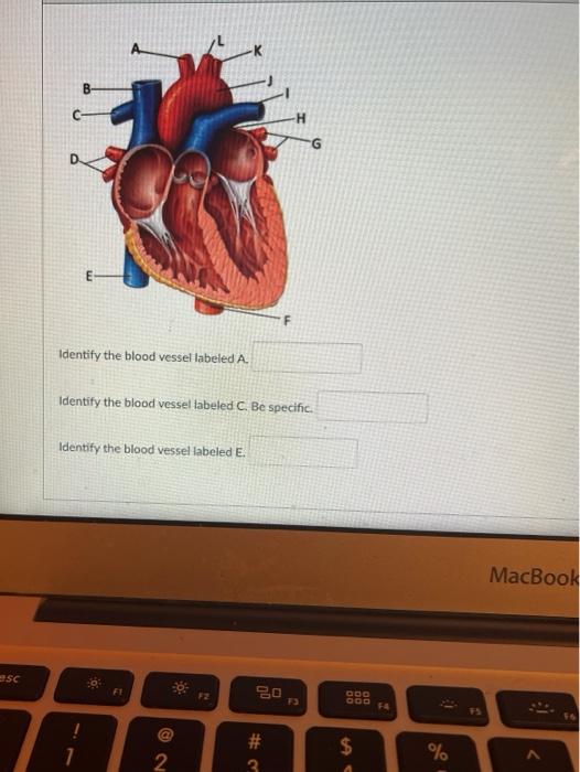 Solved H G E Identify the blood vessel labeled A. Identify | Chegg.com
