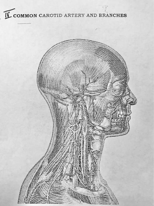 Solved IK COMM COMMON CAROTID ARTERY AND BRANCHES | Chegg.com