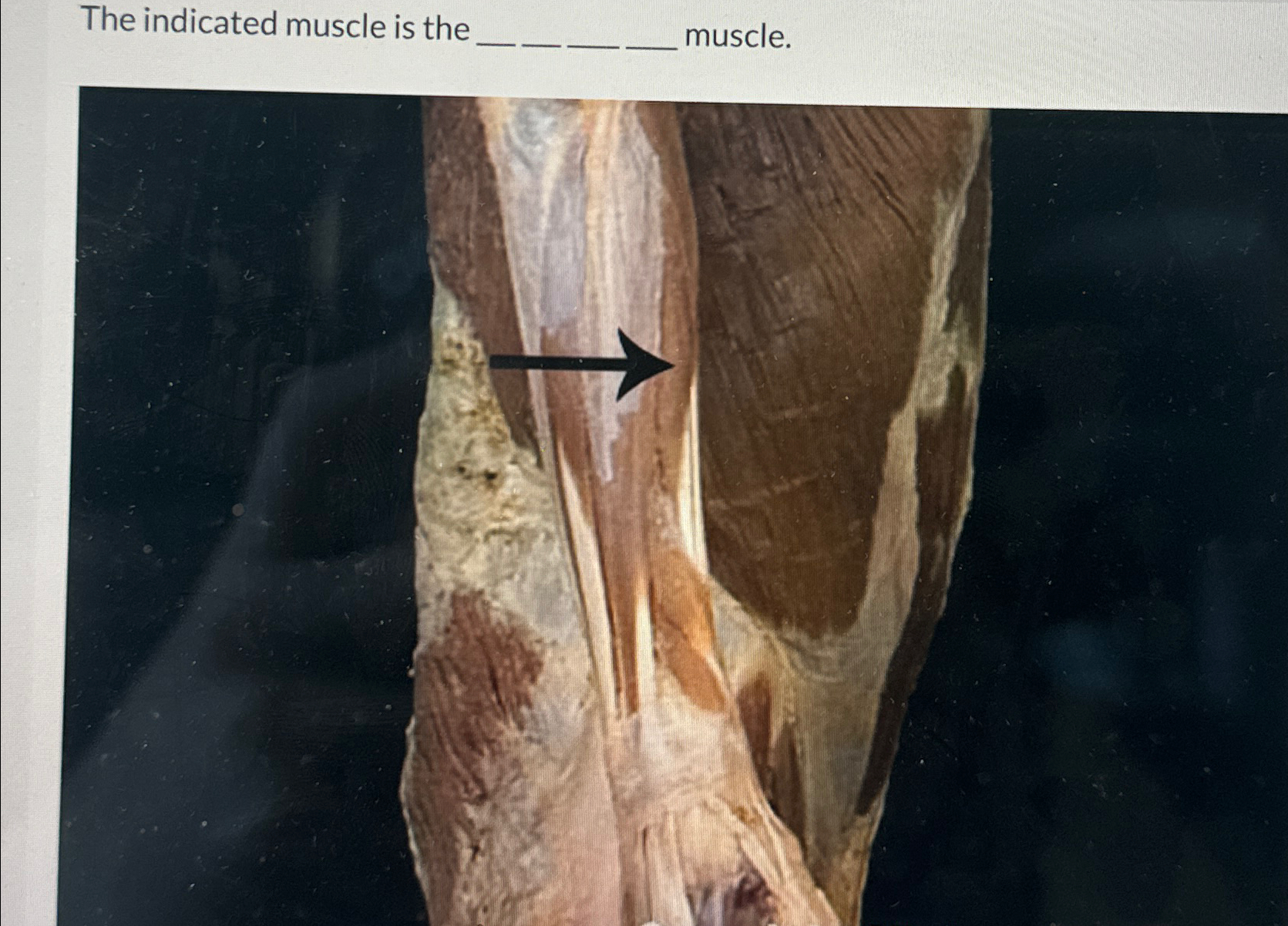 Solved The indicated muscle is the muscle. | Chegg.com