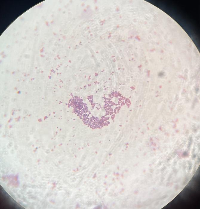 Solved Identify this unknown bacteria on this gram stain | Chegg.com