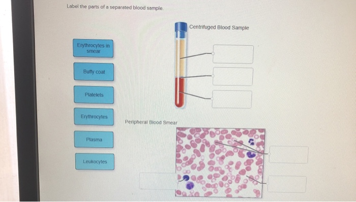 Solved Label the parts of a separated blood sample | Chegg.com