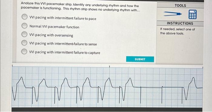 Solved Analyze this VVI pacemaker strip. Identify any | Chegg.com