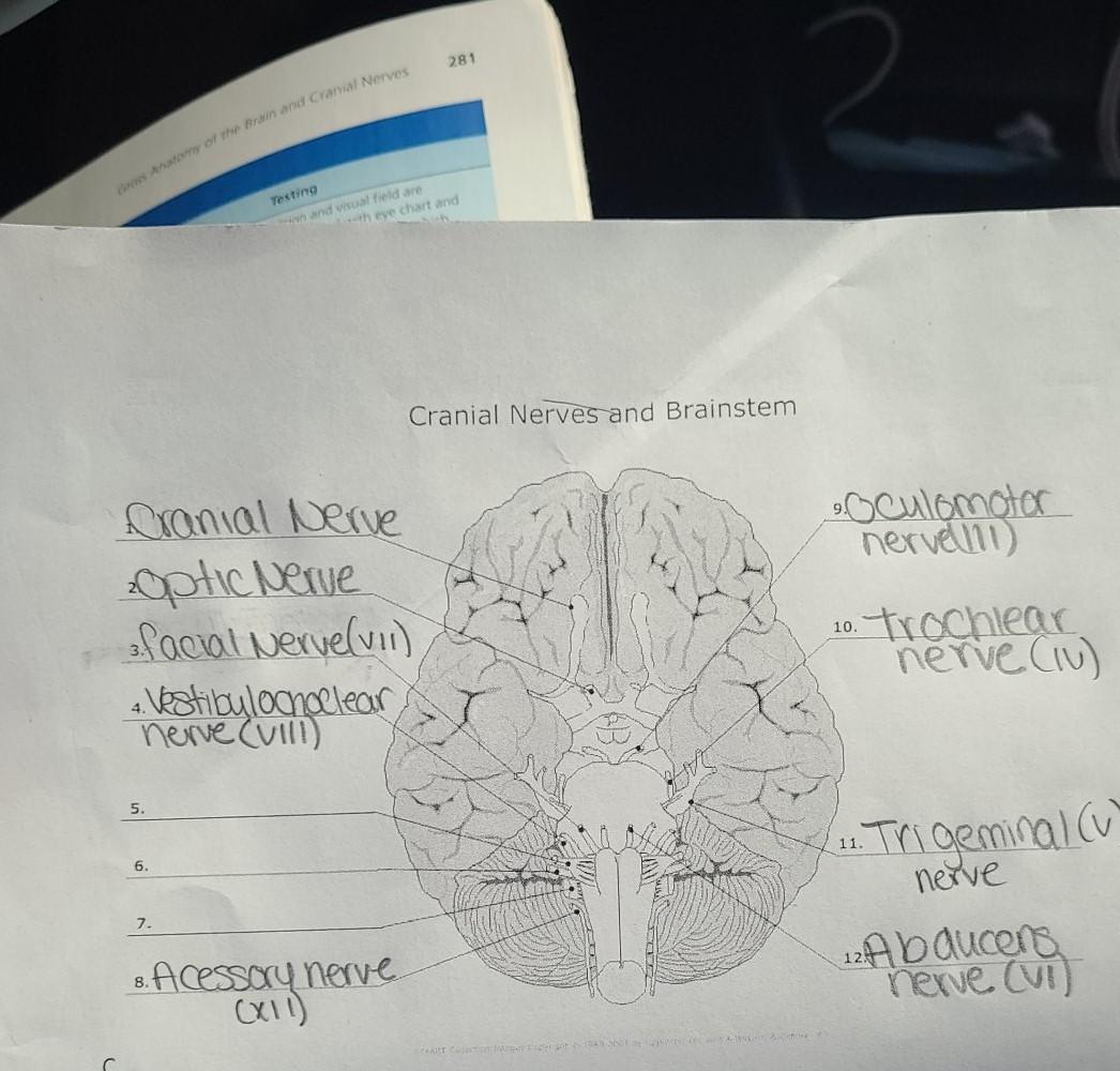 Solved 281 anns nature of the Brain and Cramal Nerves | Chegg.com
