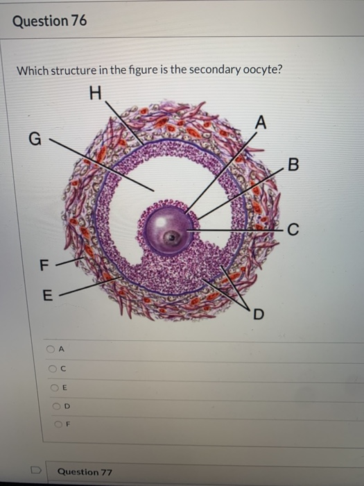 Solved Question 76 Which structure in the figure is the | Chegg.com