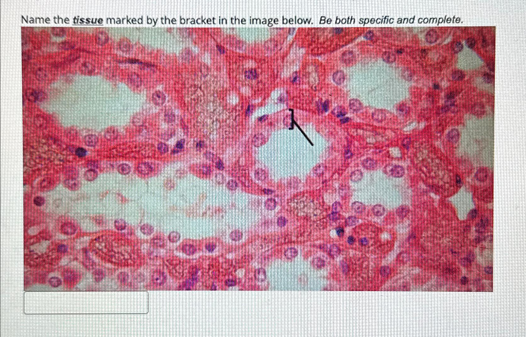 Solved Name the tissue marked by the bracket in the image | Chegg.com