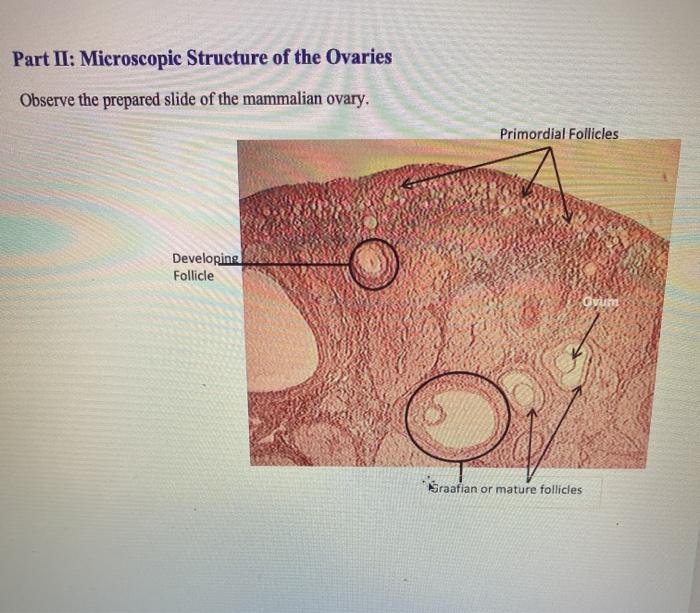 Ovary Slide Labeled Graafian Follicle