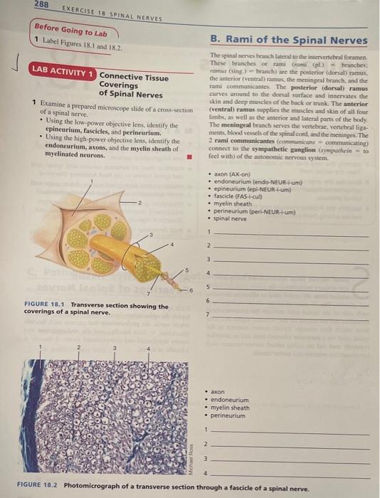 Solved 288 EXERCISE 18 SPINAL NERVES Before Going to Lab 1 | Chegg.com