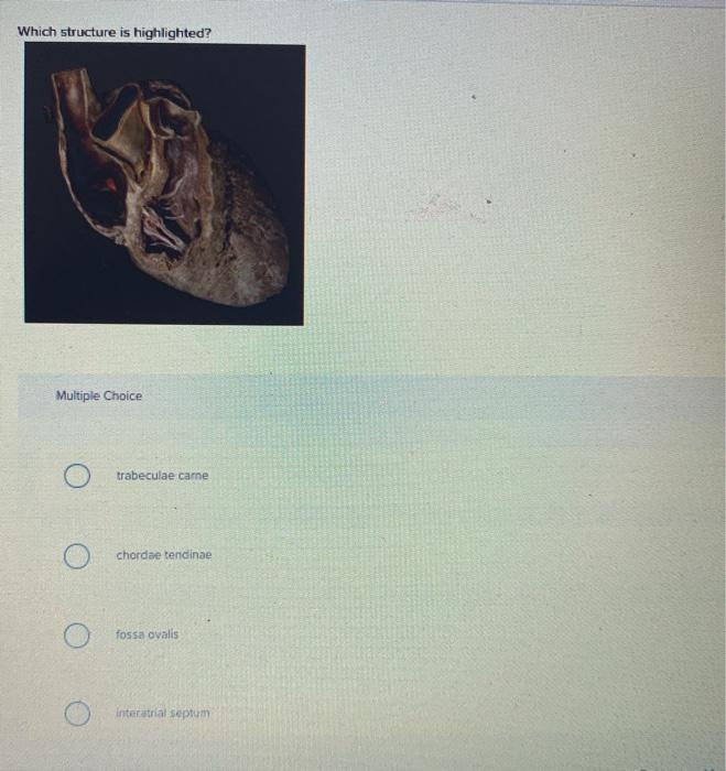 Solved Which structure is highlighted? Multiple Choice | Chegg.com