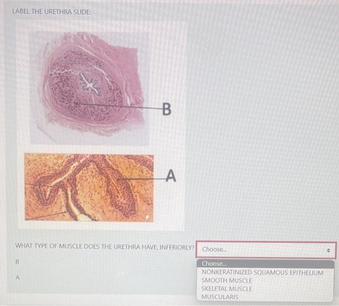Solved LABEL THE URETHRA SLIDE: B A WHAT TYPE OF MUSCLE DOES | Chegg.com