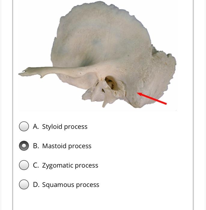 Solved O A. Styloid process B. Mastoid process C. Zygomatic | Chegg.com