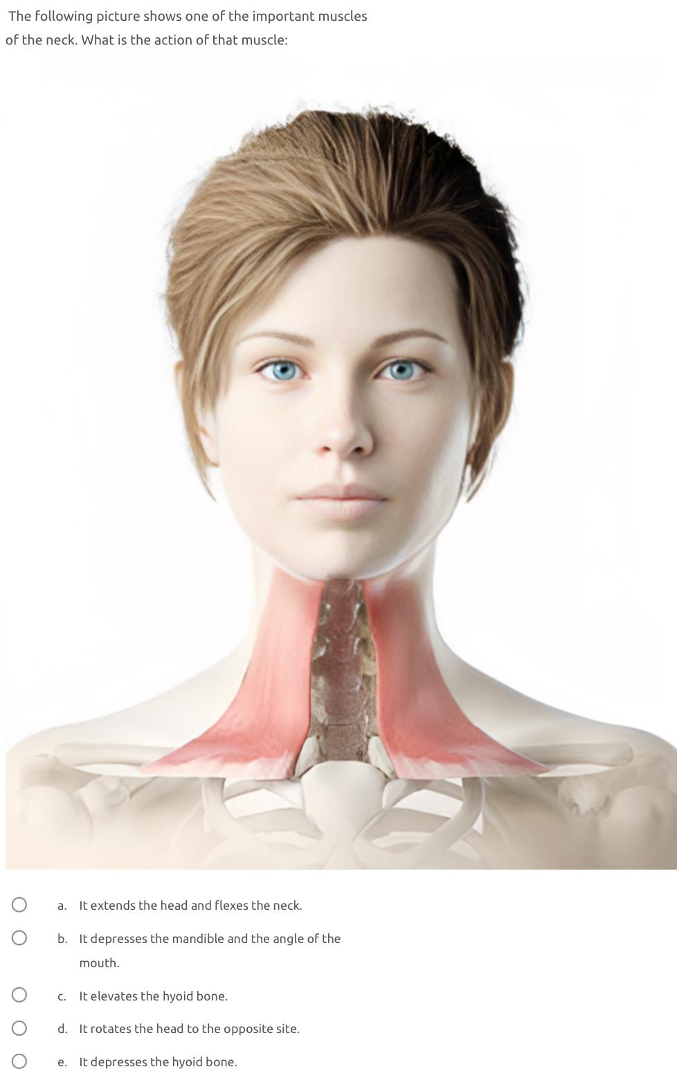 Solved The following picture shows one of the important | Chegg.com