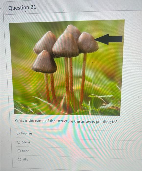 Solved What is the name of the structure the arrow is | Chegg.com