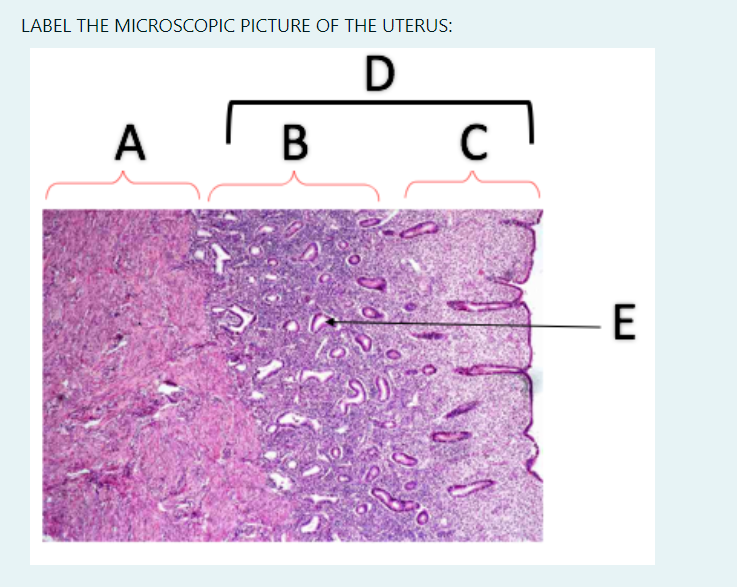 Solved LABEL THE MICROSCOPIC PICTURE OF THE UTERUS: | Chegg.com Solved LABEL THE MICROSCOPIC PICTURE OF THE UTERUS: | Chegg.com