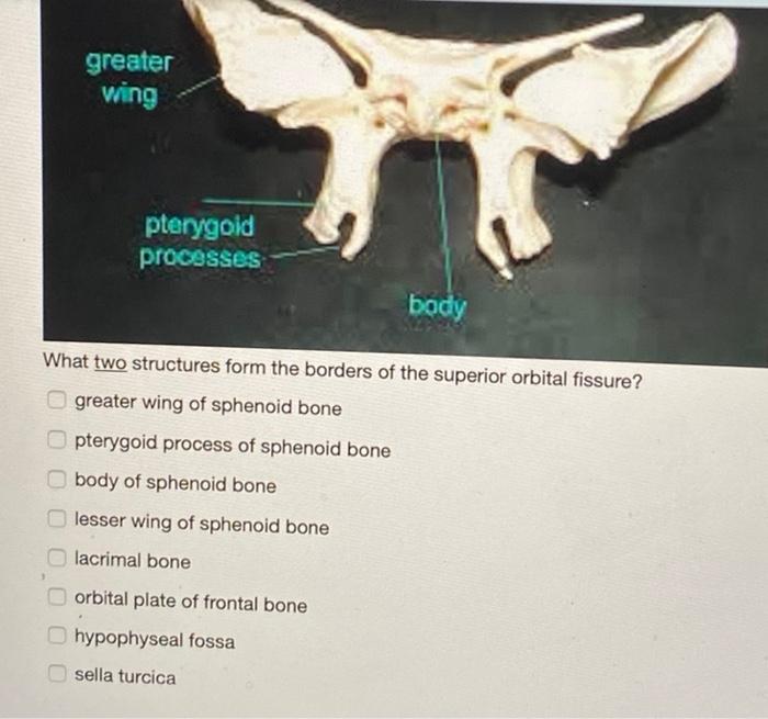 Solved greater wing pterygoid processes body What two | Chegg.com