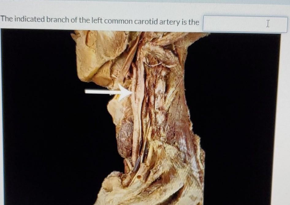 Solved The indicated branch of the left common carotid | Chegg.com