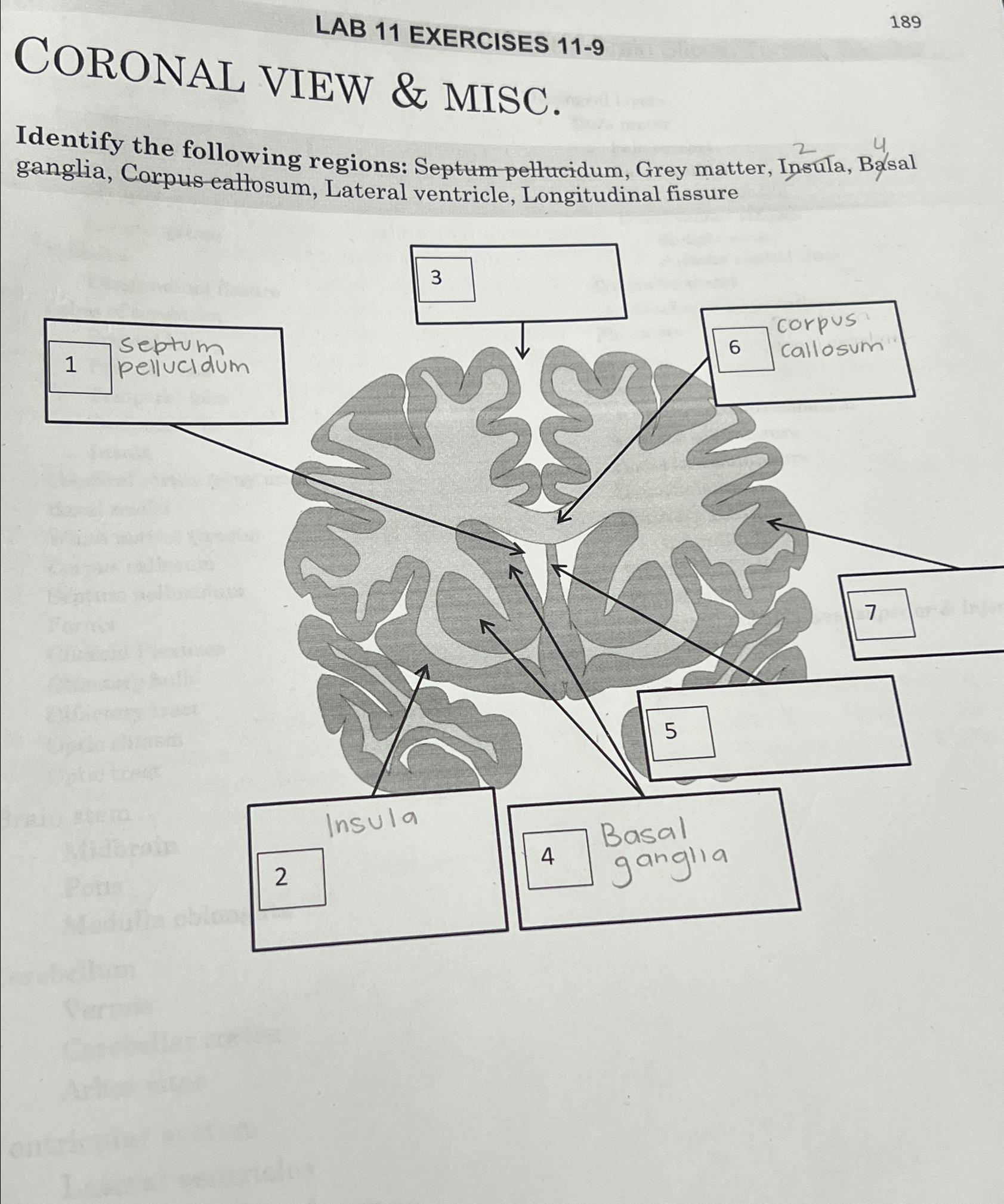 Solved LAB 11 ﻿EXERCISES 11-9189CORONAL VIEW & MISC.Identify | Chegg.com